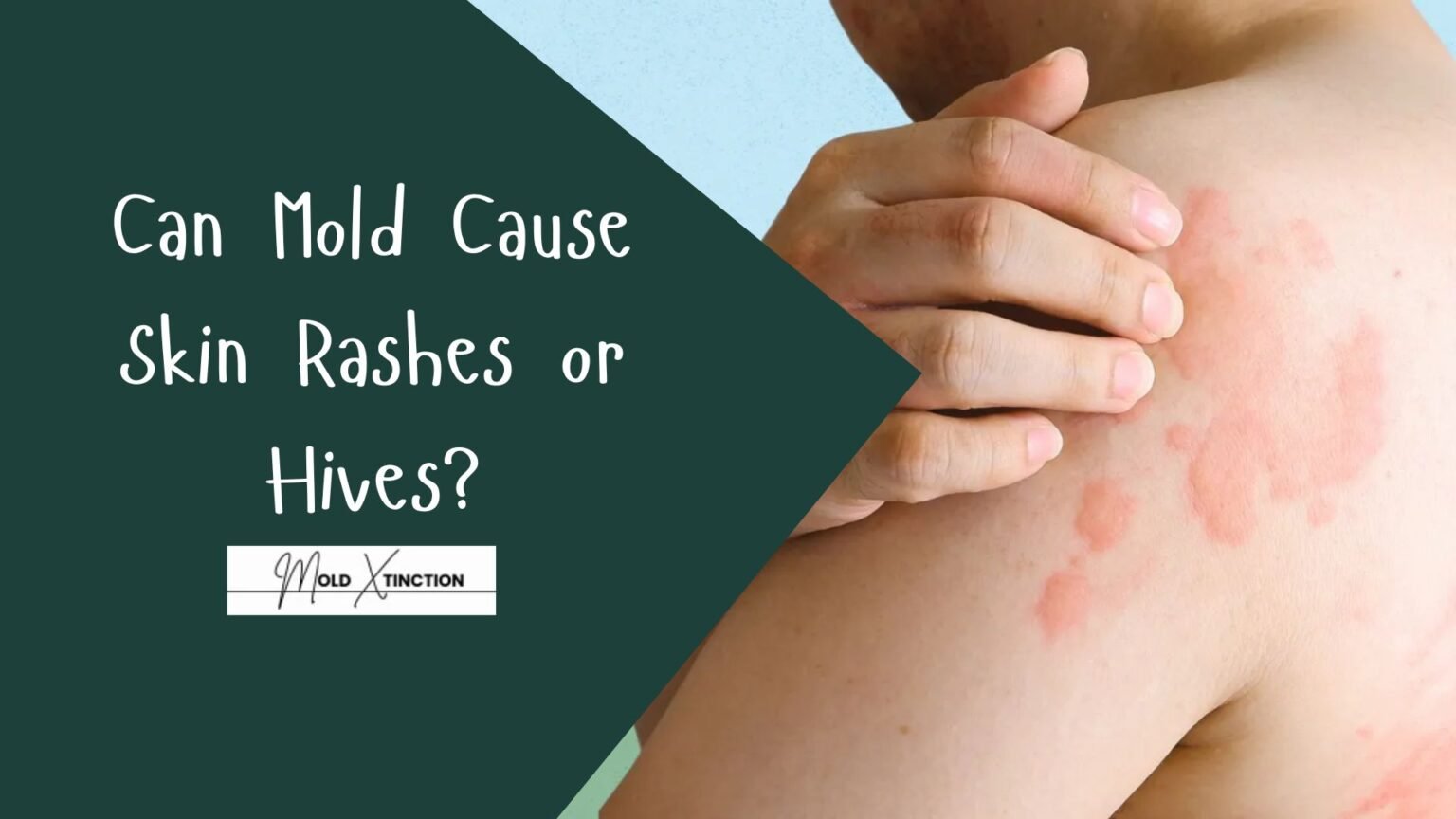 Can Mold Cause Skin Rashes or Hives?